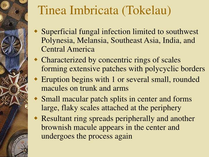 PPT - Chapter 15 Diseases Resulting from Fungi and Yeasts PowerPoint ...