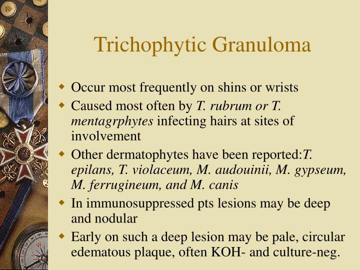 PPT - Chapter 15 Diseases Resulting from Fungi and Yeasts PowerPoint ...
