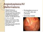 PPT - Gastrointestinal Bleeding PowerPoint Presentation - ID:547157
