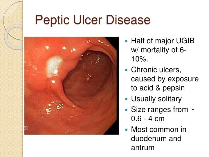 PPT - Gastrointestinal Bleeding PowerPoint Presentation - ID:547157