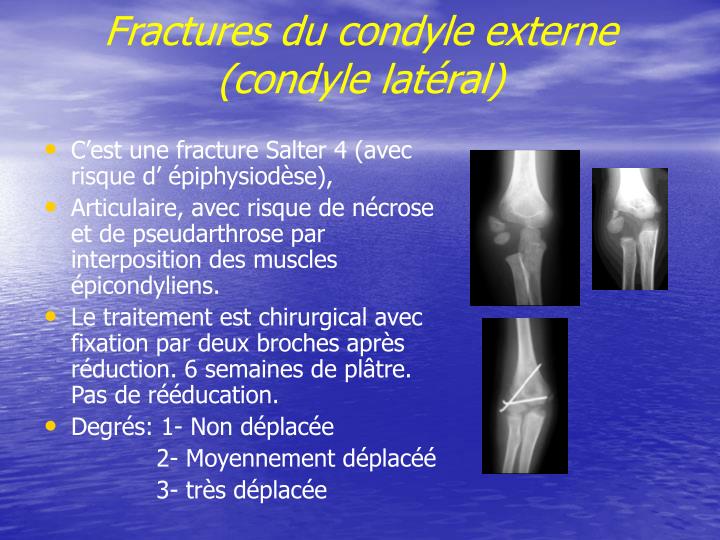 PPT - Traumatologie Infantile PowerPoint Presentation - ID:549494