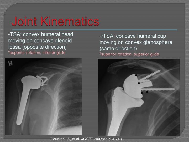 PPT - Reverse Total Shoulder Arthroplasty PowerPoint Presentation - ID ...