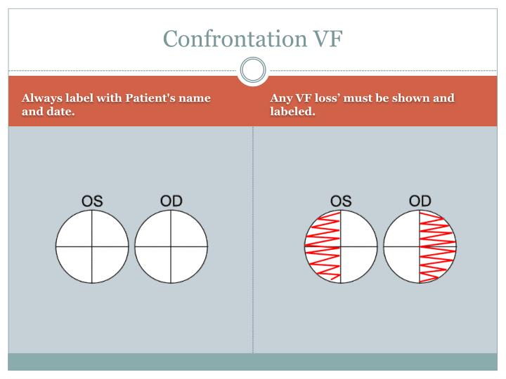 PPT Visual Field Examinations PowerPoint Presentation ID 550558 PPT Visual Field Examinations PowerPoint Presentation ID 550558