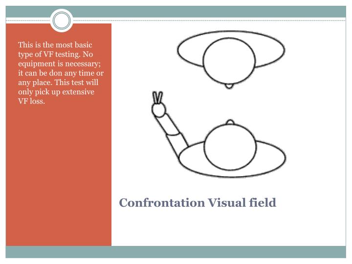 PPT - Visual Field Examinations PowerPoint Presentation - ID:550558