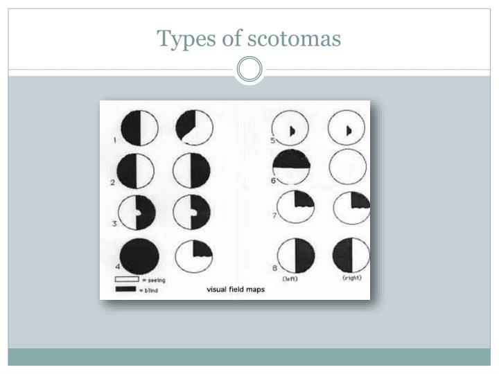 PPT - Visual Field Examinations PowerPoint Presentation - ID:550558