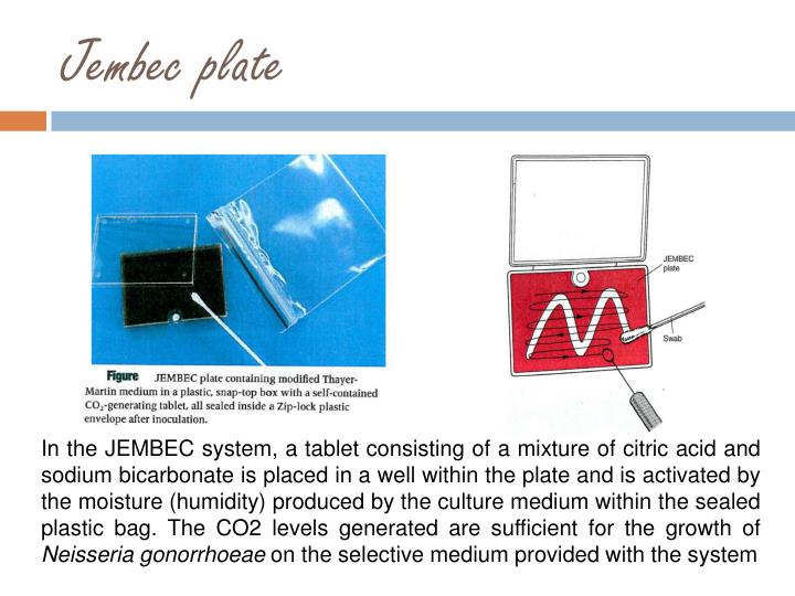 PPT - Thayer - Martin agar PowerPoint Presentation - ID:554606