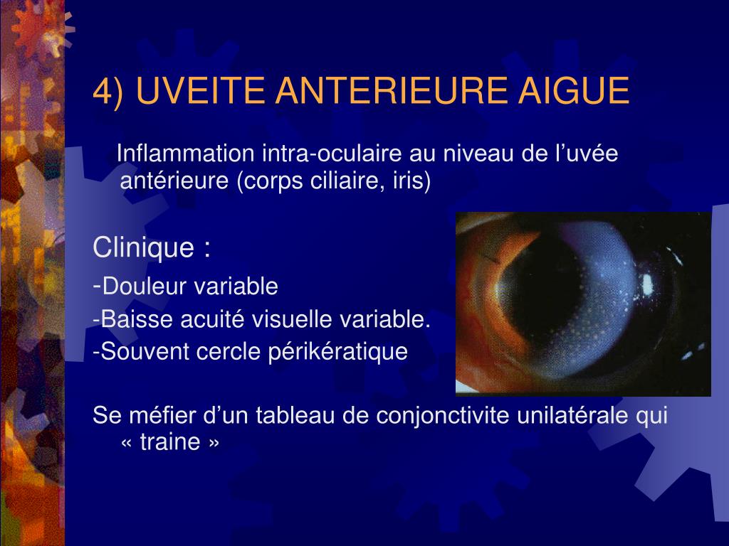 PPT - L’ŒIL ROUGE ET IRRITE DU SUJET AGE PowerPoint Presentation, free ...