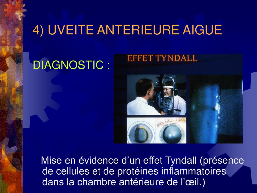 PPT - L’ŒIL ROUGE ET IRRITE DU SUJET AGE PowerPoint Presentation, free ...