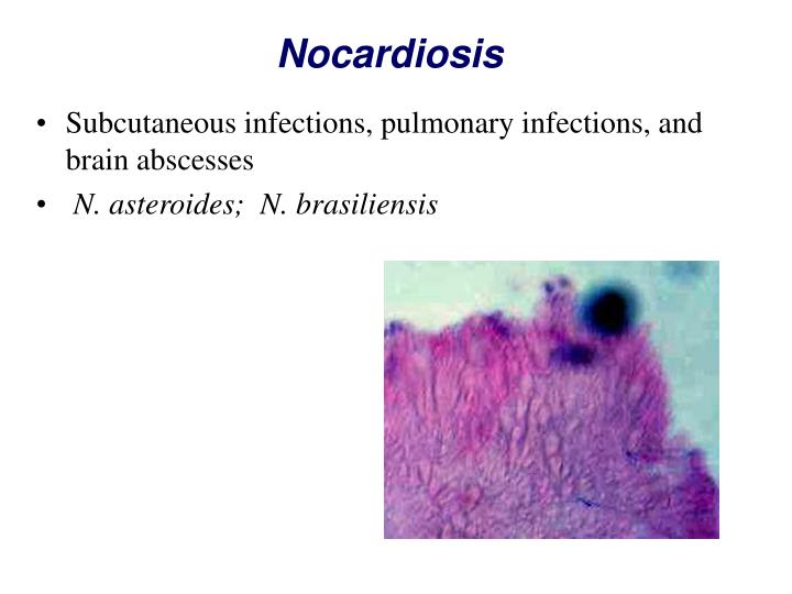 PPT - Actinomyces & Nocardia PowerPoint Presentation - ID:560356