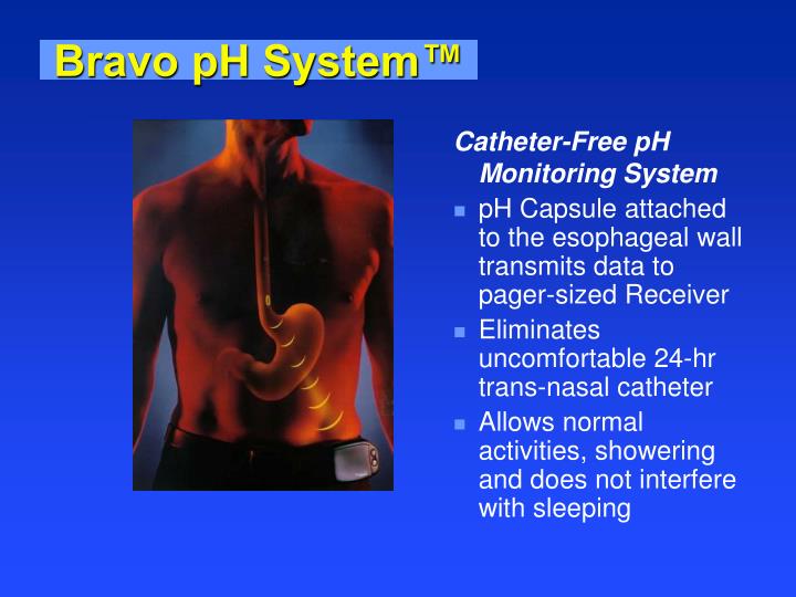 PPT - Chest pain of unknown origin (CPUO): role of the esophagus ...