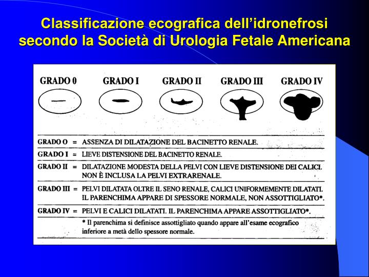 PPT - Pielectasia ed idroureteronefrosi nella patologia pediatrica da ...