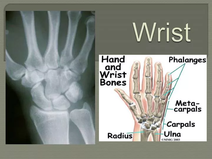 PPT - Wrist PowerPoint Presentation, free download - ID:571361