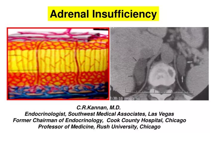 PPT - C.R.Kannan, M.D. Endocrinologist, Southwest Medical Associates ...