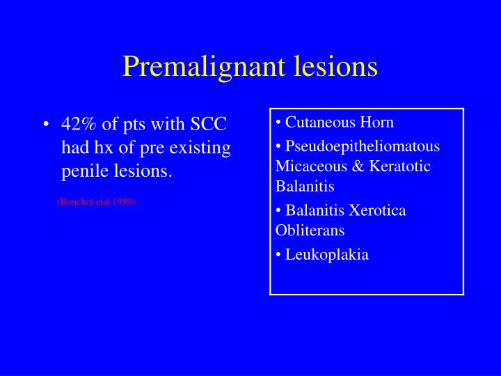 PPT - Penile Cancer PowerPoint Presentation - ID:583293