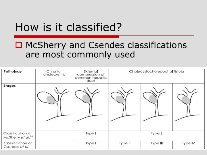 PPT - Mirizzi Syndrome An Uncommon Gallstone Complication PowerPoint ...