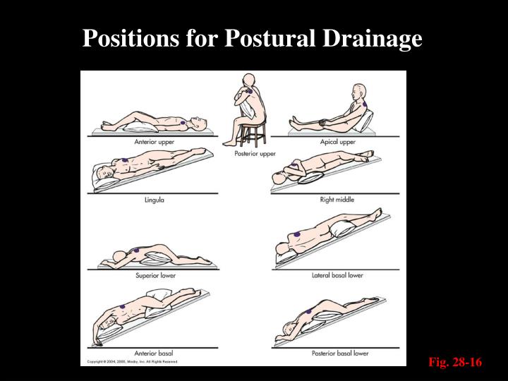 PPT - Chronic Obstructive Pulmonary Disease (COPD) PowerPoint ...