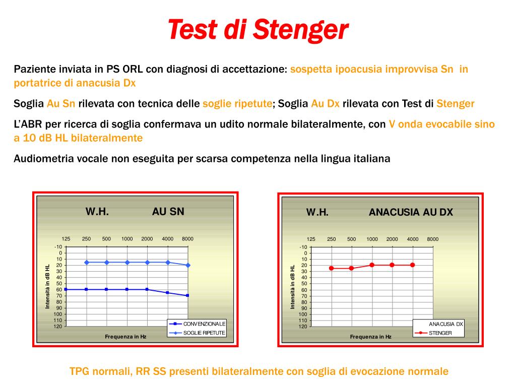 PPT - L’esame audiometrico nel soggetto non collaborante: la ...