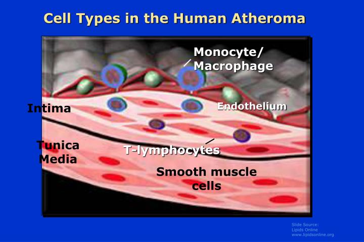 PPT - Pathogenesis of Acute Coronary Syndromes Nathan Wong PowerPoint ...