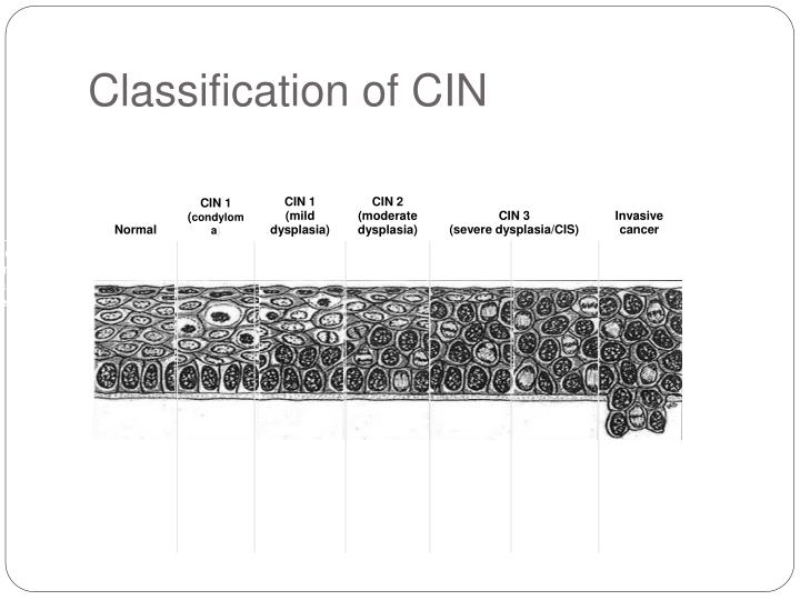 PPT - Benign and premalignant disease of the cervix PowerPoint ...