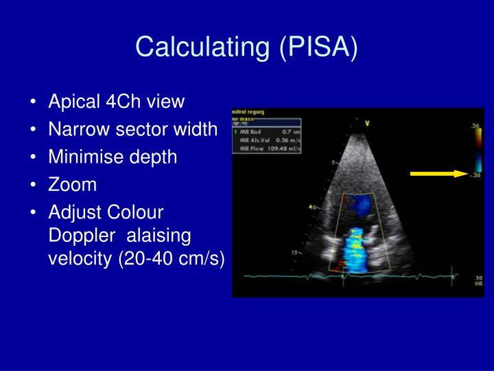 PPT - How to Diagnose and Assess Severity of Mitral Regurgitation by ...