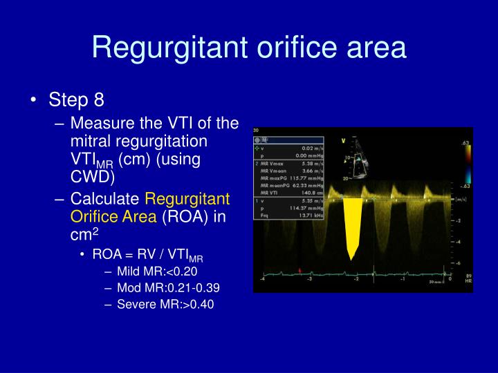 PPT - How to Diagnose and Assess Severity of Mitral Regurgitation by ...