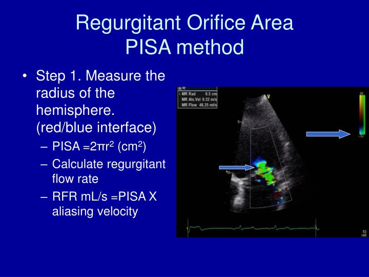 PPT - How to Diagnose and Assess Severity of Mitral Regurgitation by ...