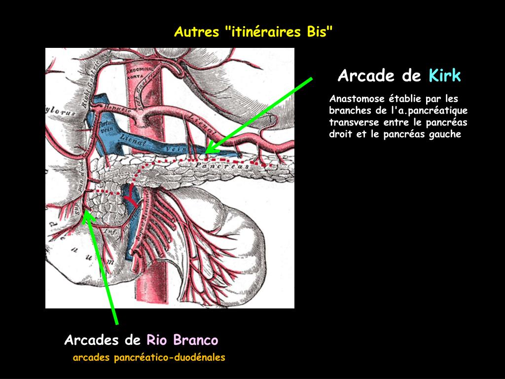 PPT - Homme de 48 ans, tabagique actif, ayant présenté un 1 er épisode ...