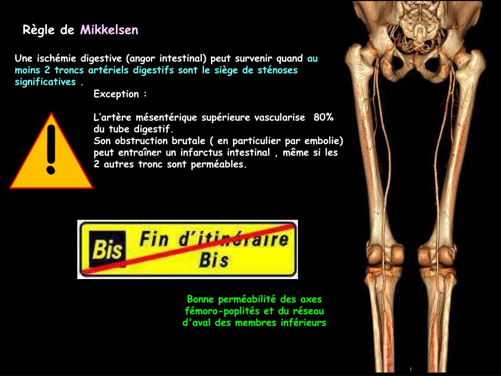 PPT - Homme de 48 ans, tabagique actif, ayant présenté un 1 er épisode ...