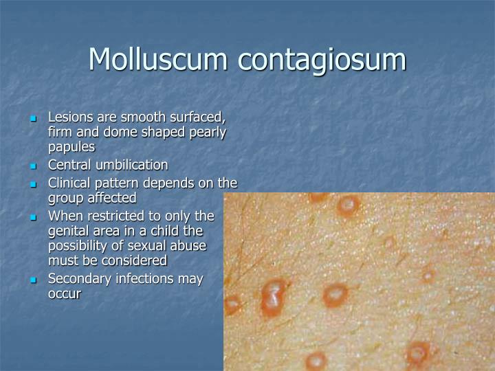 PPT - VIRAL DISEASES Part II PowerPoint Presentation - ID:595516