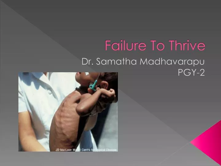 PPT - Failure To Thrive PowerPoint Presentation, free download - ID:596168 PPT - Failure To Thrive PowerPoint Presentation, free download - ID:596168