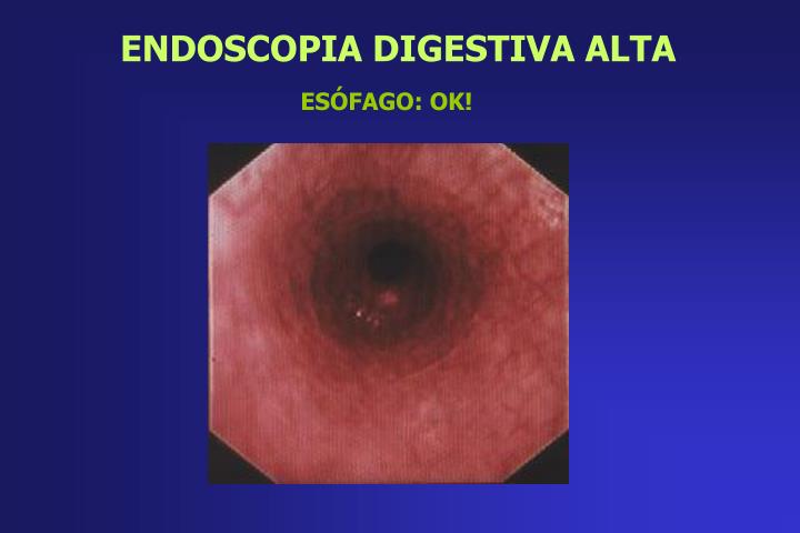PPT - ENDOSCOPIA ALTA DIAGNÓSTICA: INDICACIONES Y COMPLICACIONES ...