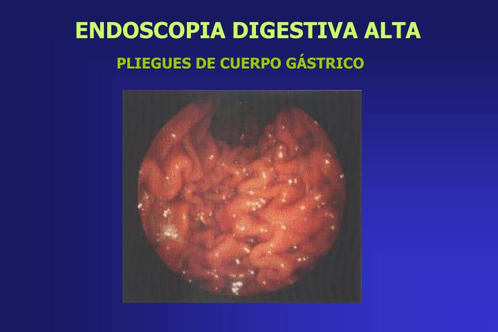 PPT - ENDOSCOPIA ALTA DIAGNÓSTICA: INDICACIONES Y COMPLICACIONES ...