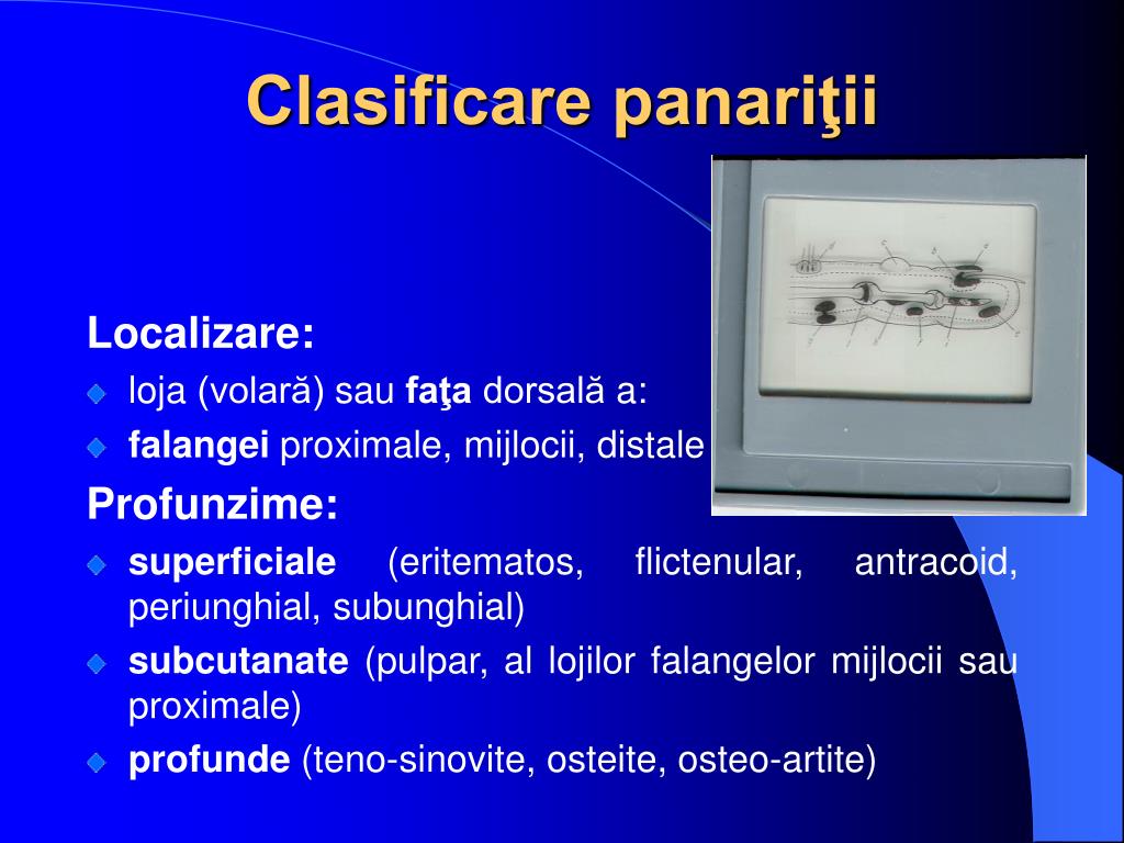 PPT - Infecţii acute ale mâinii şi degetelor PowerPoint Presentation ...