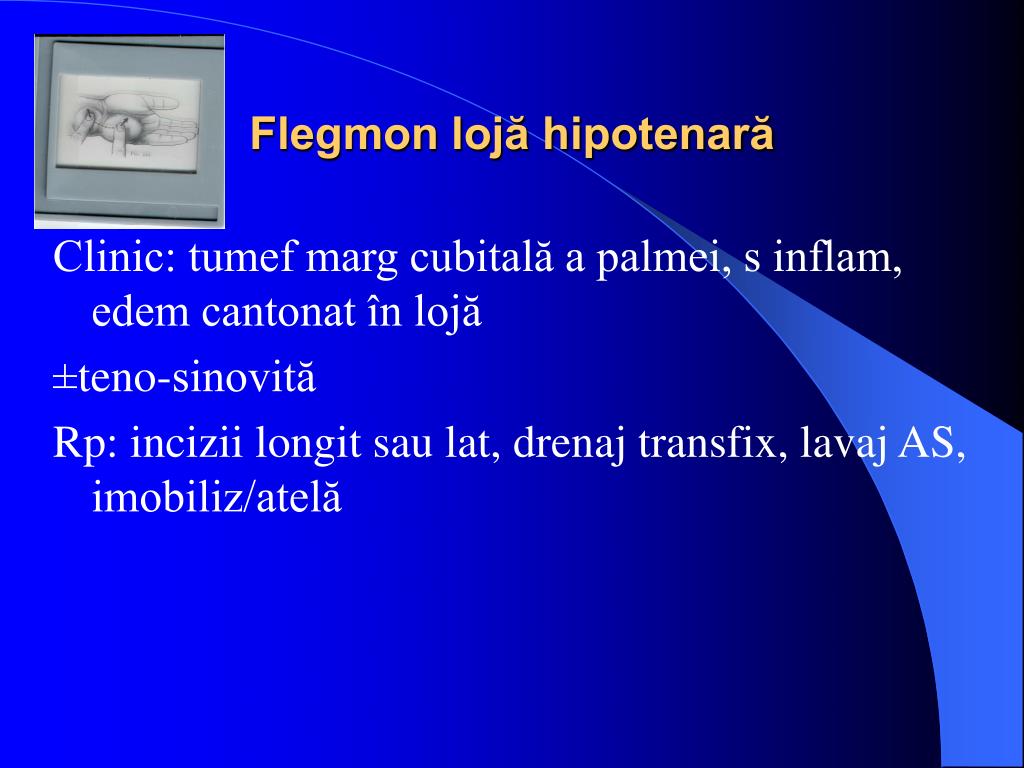 PPT - Infecţii acute ale mâinii şi degetelor PowerPoint Presentation ...