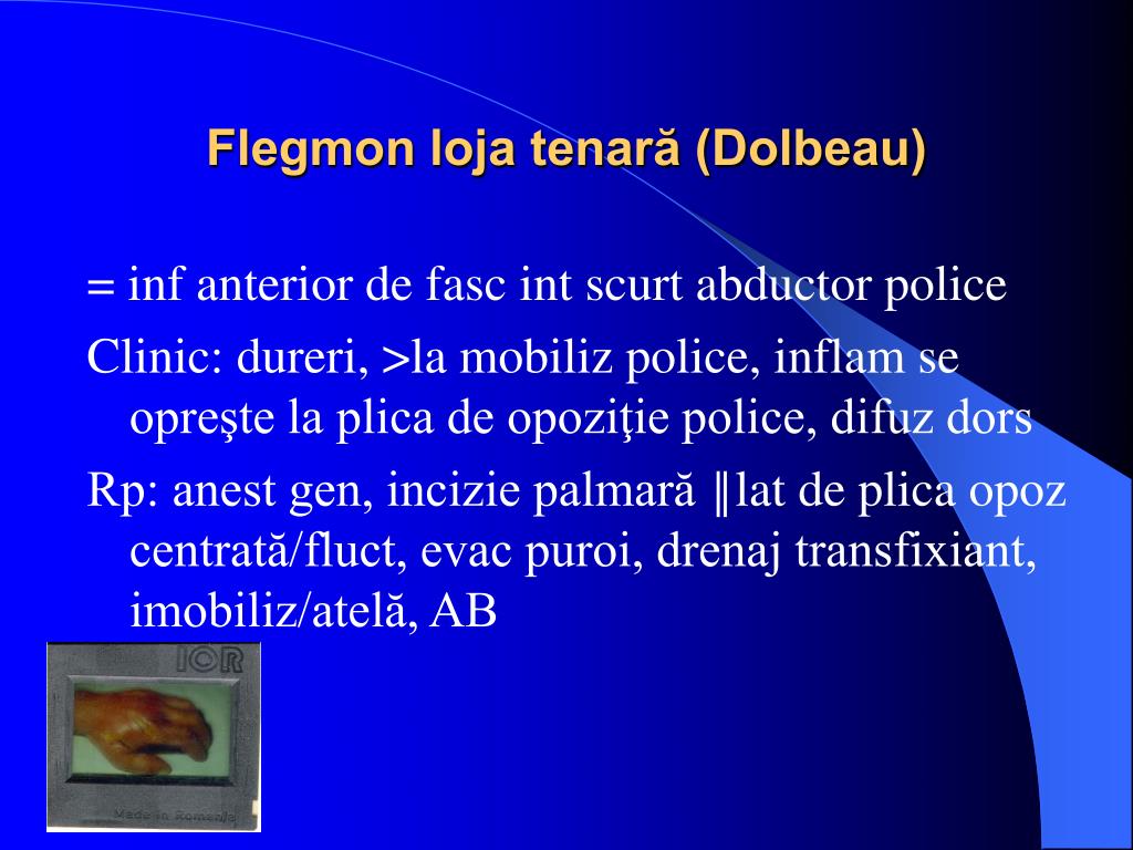PPT - Infecţii acute ale mâinii şi degetelor PowerPoint Presentation ...
