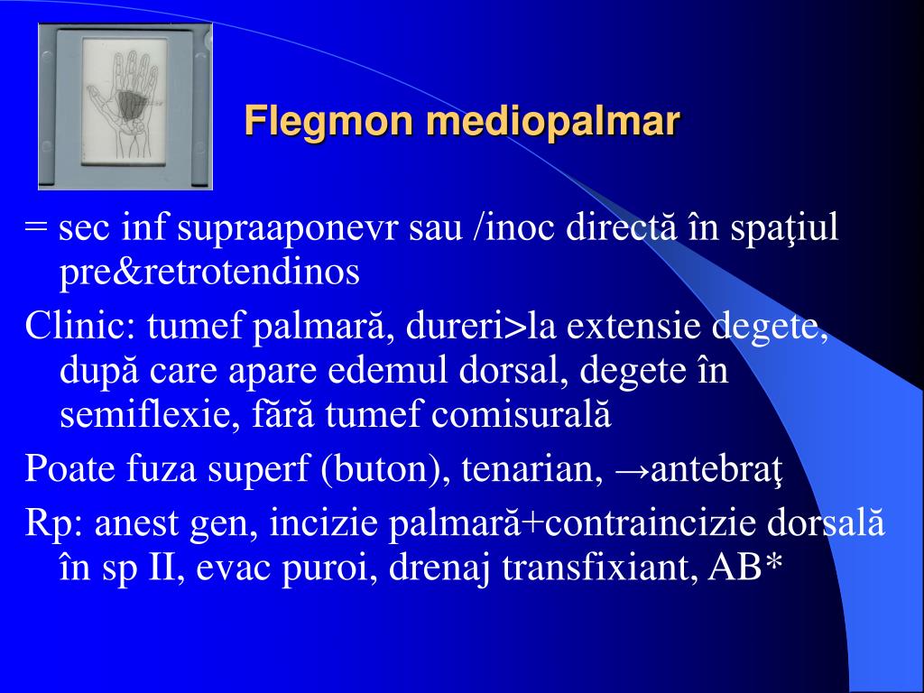 PPT - Infecţii acute ale mâinii şi degetelor PowerPoint Presentation ...