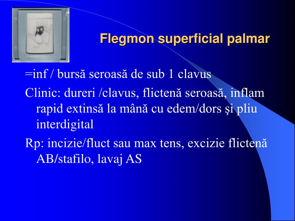 PPT - Infecţii acute ale mâinii şi degetelor PowerPoint Presentation ...