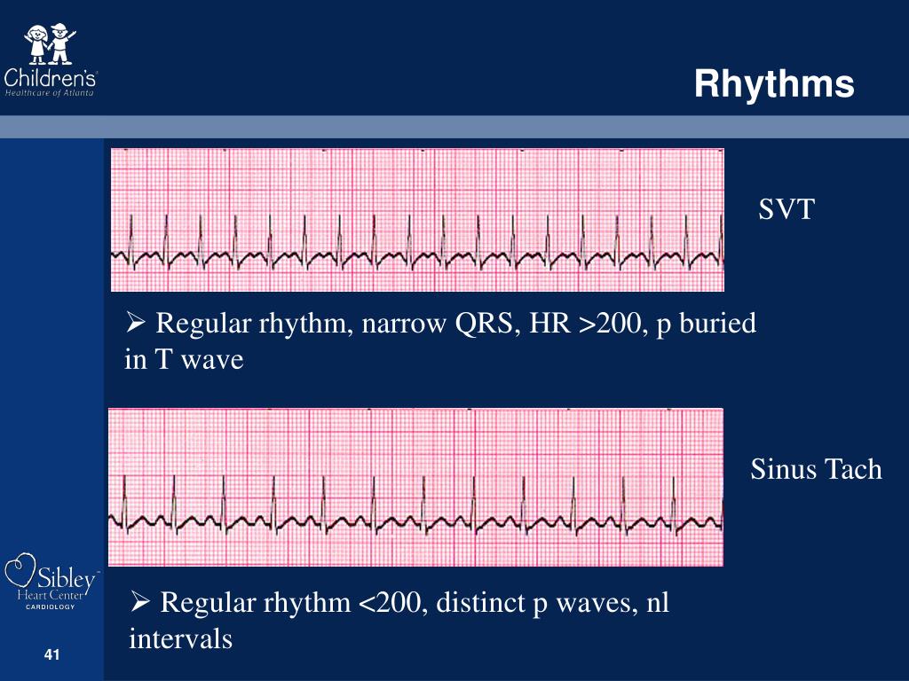 PPT Approach To Common Cardiac Emergencies PowerPoint Presentation PPT Approach To Common Cardiac Emergencies PowerPoint Presentation