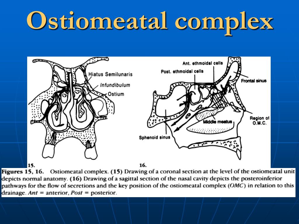 PPT Anatomic Variations In Paranasal Sinus Region And Their Clinical