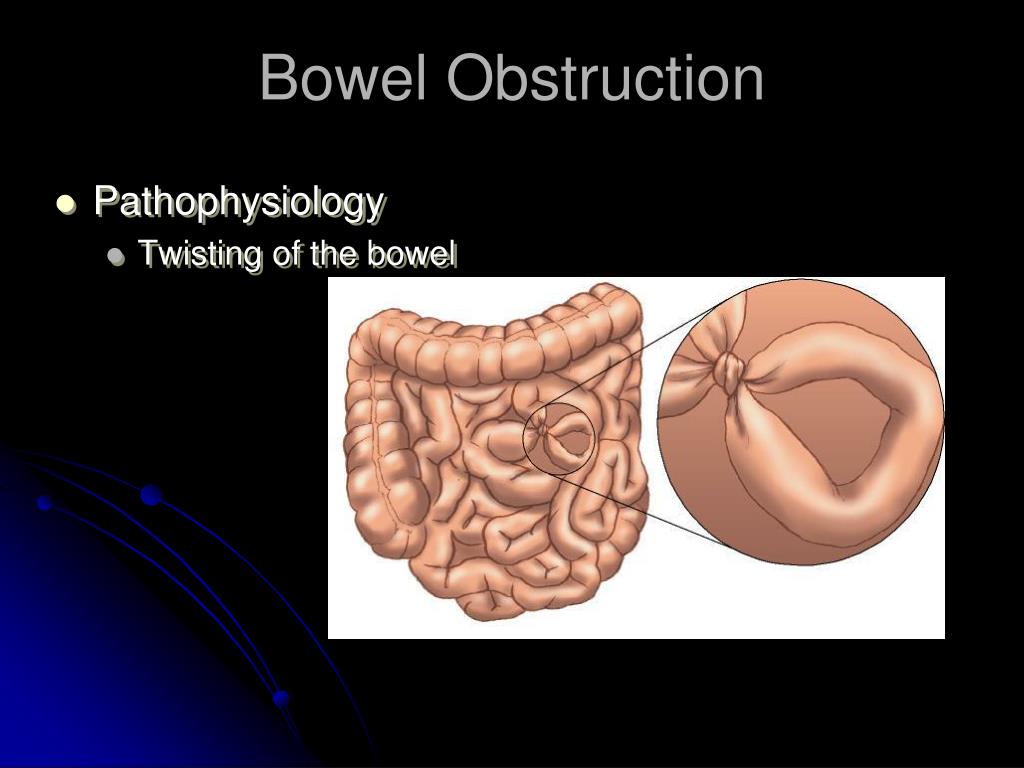 PPT - Gastroenterology “A Cute Abdomen” Dr Baxter Larmon Professor UCLA ...
