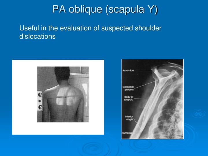 PPT - Shoulder PowerPoint Presentation - ID:604974