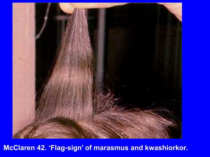 PPT - Protein Status PowerPoint Presentation - ID:605300