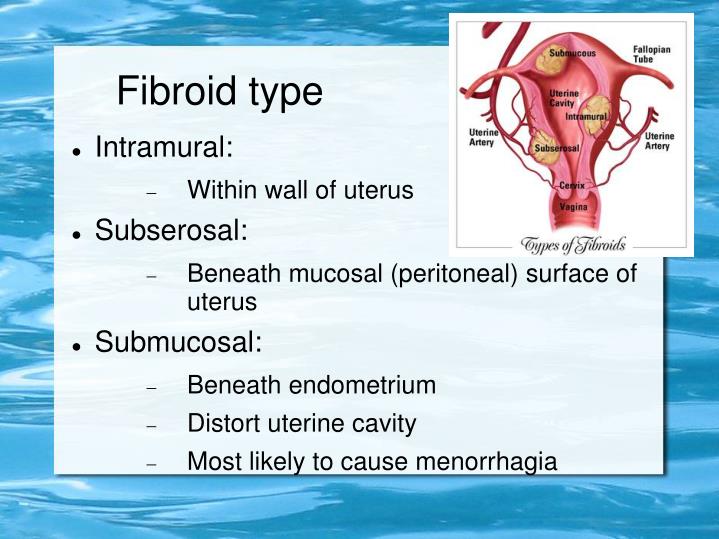 PPT - Menorrhagia PowerPoint Presentation - ID:608684