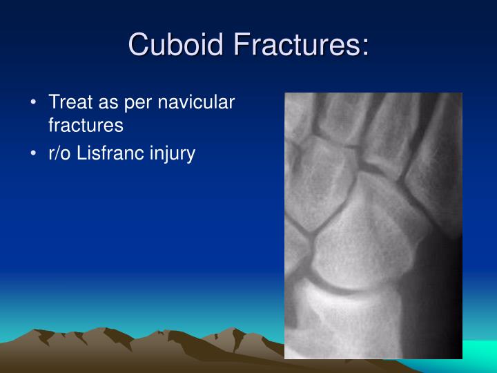 PPT - Foot and Ankle Fractures PowerPoint Presentation - ID:611999