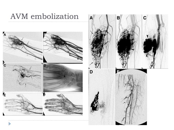 PPT - Congenital Vascular Malformations PowerPoint Presentation - ID:614617