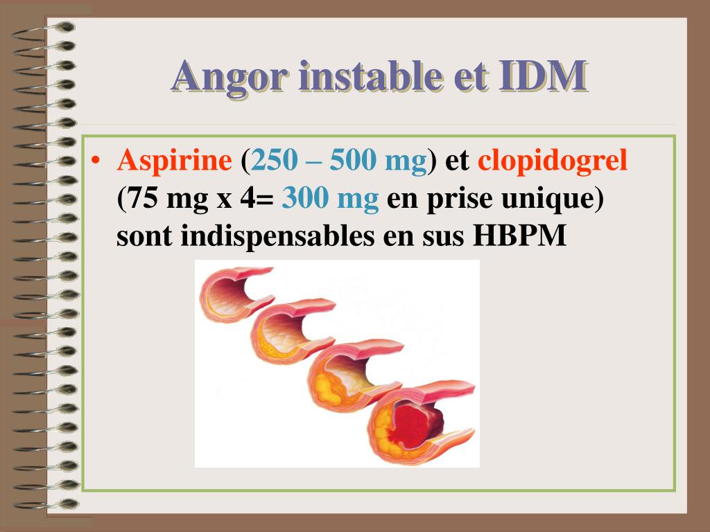PPT - ANTIAGREGANTS ET ANTICOAGULANTS EN CARDIOLOGIE PowerPoint ...