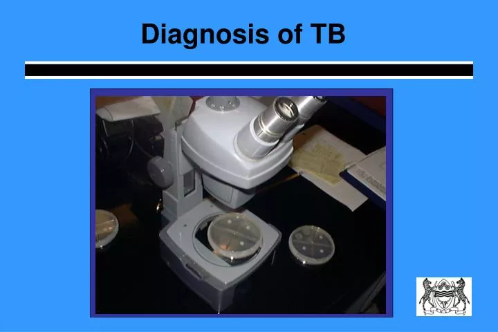 PPT - Diagnosis of TB PowerPoint Presentation, free download - ID:620371