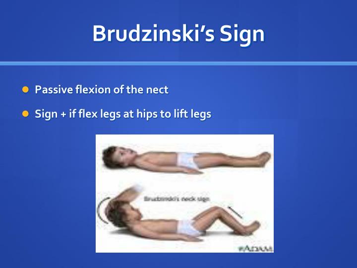 PPT - Seizures and CNS Infections PowerPoint Presentation - ID:621709