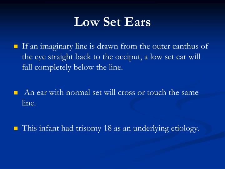 PPT - Common Newborn Findings PowerPoint Presentation - ID:625692