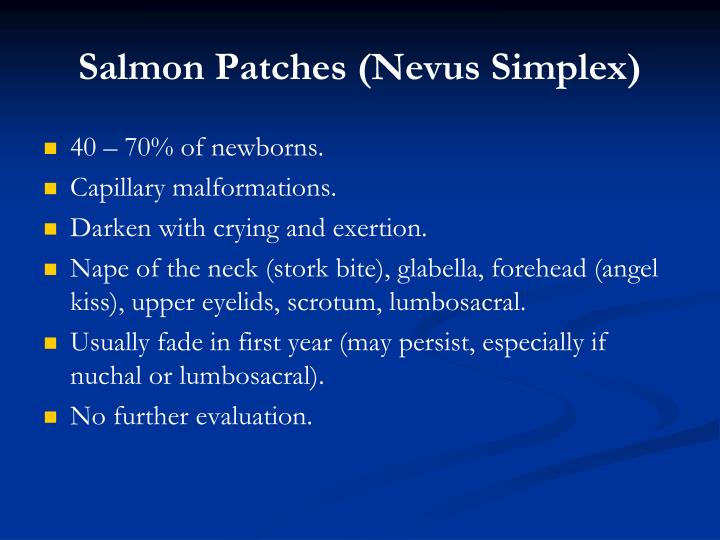 PPT - Common Newborn Findings PowerPoint Presentation - ID:625692